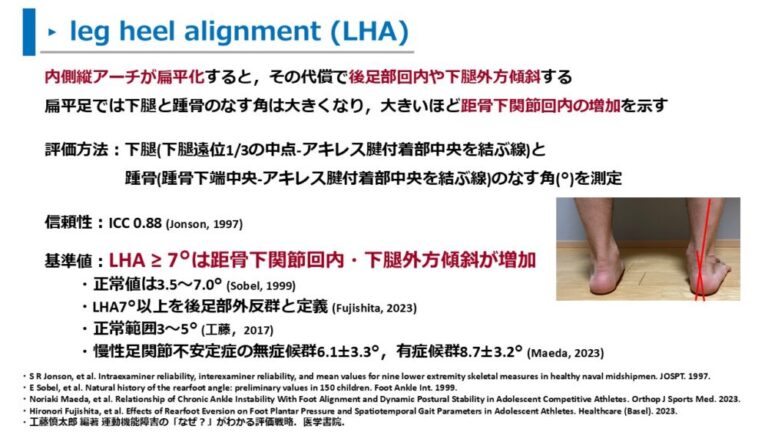 【扁平足】解剖学的な特徴と簡単に評価できる3つの方法【評価スケール】”toe many toes sign”・”leg heel ...
